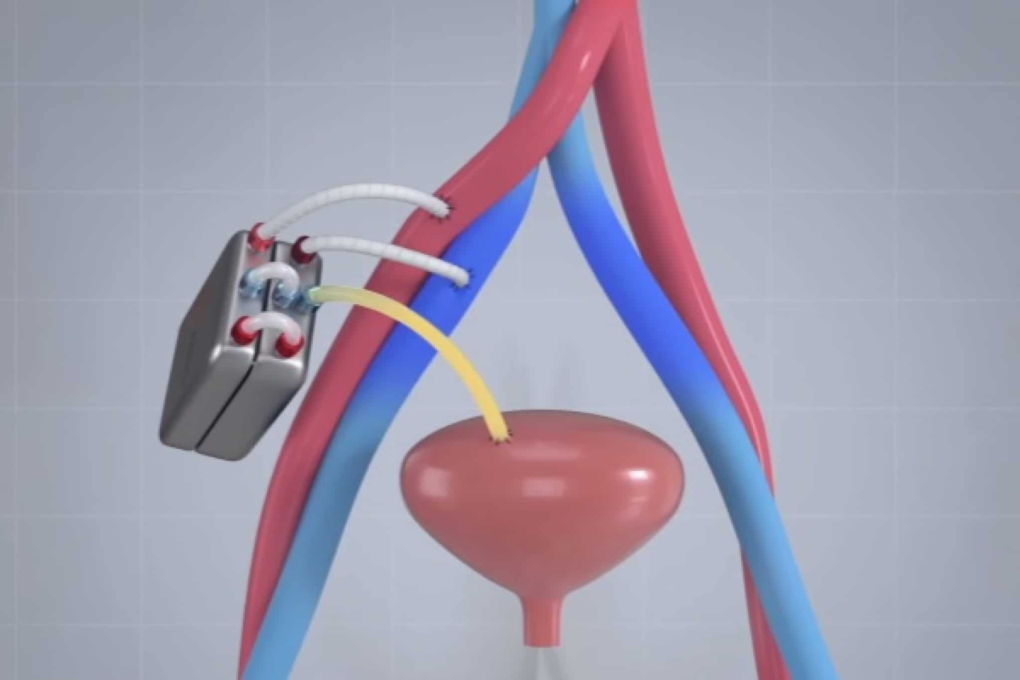 Pesquisadores testam com sucesso protótipo de rim bioartificial ...