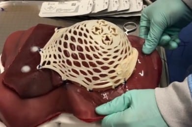 Nova técnica usa princípios do kirigami para auxiliar na reconstrução ...